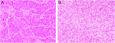 Carcinoma Classification - OxML 2023 Cases